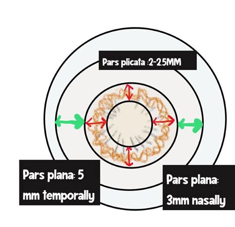 Anatomy Of The Ciliary Body Insight Ophthalmology
