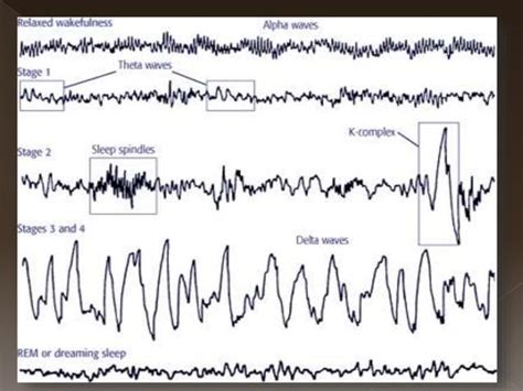 Sleep Scoring Newpptx