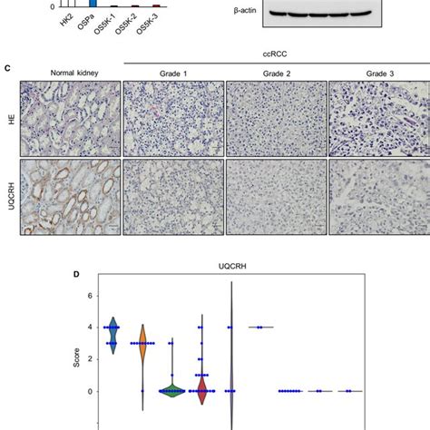 Integrative Analysis Of Ccrcc Derivatives Using Gene Expression And Dna Download Scientific