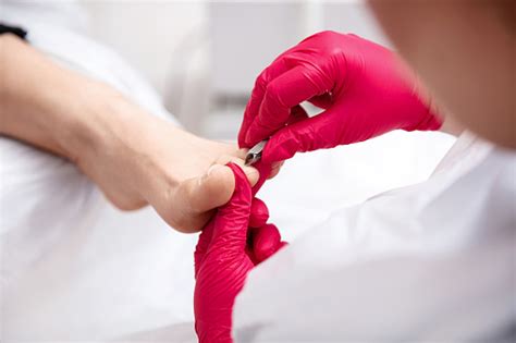 전문 의료 페디큐어 절차의 클로즈업 네일 클리퍼 악기로 포드 학자의 손 2명에 대한 스톡 사진 및 기타 이미지 2명 건강관리와 의술 깨끗한 Istock