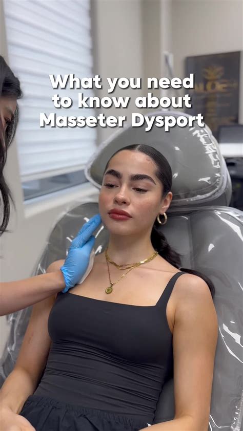 Masseter Dysport