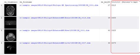 Searching For Numbers In Dicom Text Tags Yohz Software Development Blog