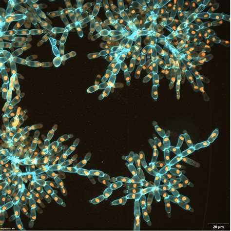 Researchers Direct Evolution To Make Superyeast 20000 Times Bigger