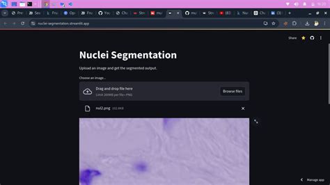 Nuclei Segmentation Application With Streamlit Muhammad Rizwan Posted On The Topic Linkedin