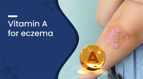 Vitamin A For Eczema Benefits Uses And Skin Healing Support Zeelab