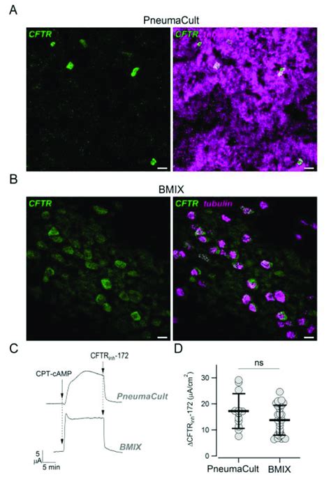 Effect Of Culture Medium On Cftr Expression Pattern A B Detection Of Download Scientific