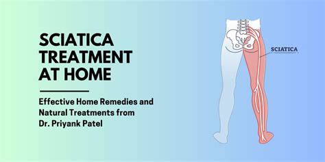 Sciatica Treatment At Home The Spine Clinics