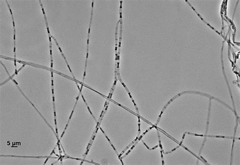 Clinical Mycology Microbiology Learning The Whyology Of Microbial Testing