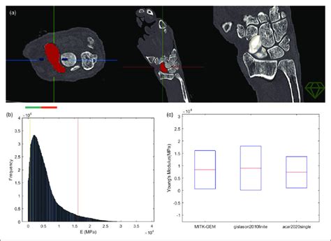 A Segmentation Of The Scaphoid Bone Into Fore And Background Download Scientific Diagram