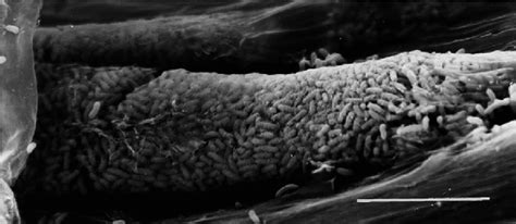 Micro Colony Of Pseudomonas Fluorescens Strain Wcs365 On The Tomato Download Scientific Diagram