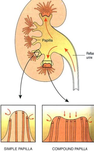 Path Review Guide Flashcards Quizlet