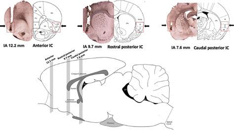 Insular Cortex Diagram