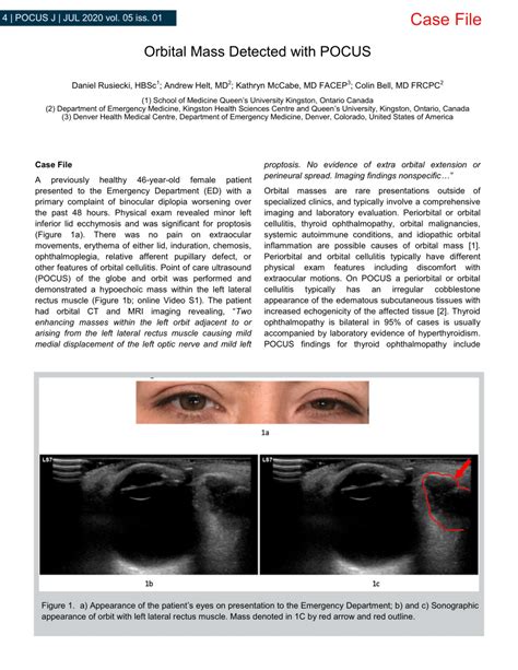 Pdf Orbital Mass Detected With Pocus