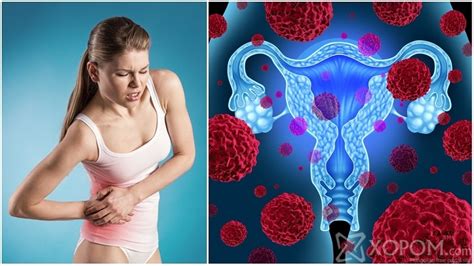 Эмэгтэйчүүдийг элгэндээ онцгой анхаарал хандуулахыг зөвлөж байна Яагаад тийм шаардлагатай вэ гэвэл…