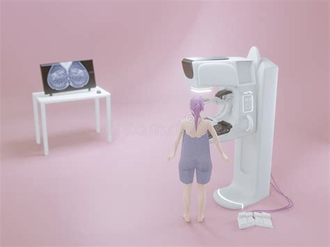 Mammography Device For Screening Breast Cancer 3d Woman Model Stock Illustration