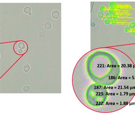 Pdf Yeast Morphology Assessment Through Automated Image Analysis