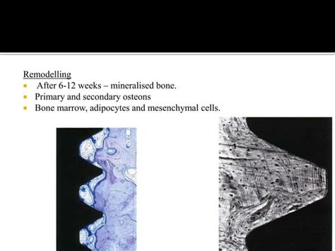 Osseointegration Pptx Dental Health Diseases And Conditions