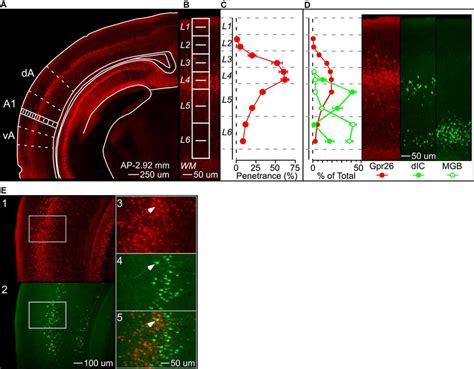 Gpr26 Cells Form A Dense Band In Layer 4 Of Auditory Cortex A We Download Scientific Diagram