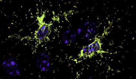Sex Differences In Brain Cell Development Offer Clues Into Disease Risk