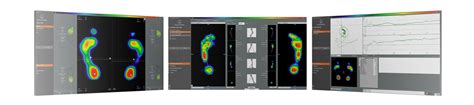 Transform Your Chiropractic Practice With Advanced Spine And Gait Analysis Axisage Clinical