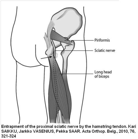 Left Proximal Hamstring Strains Of The Hamstring Muscles Occur