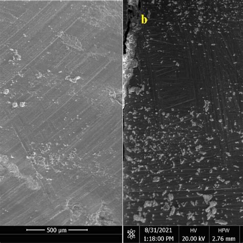 Sem Micrograph Of Dentin Surface After Cleaning Of Non Eugenol Download Scientific Diagram