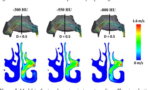 Figure 5 From Computational Fluid Dynamics Modeling In Respiratory