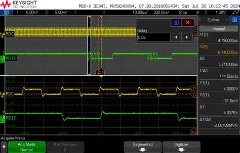 Ethernet Smi Mdc Polarity Incorrect Nxp Community