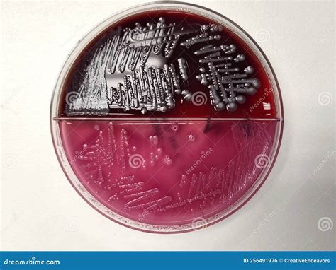 Xld Agar E Coli