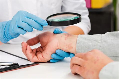 Eczema In Singapore The Dermatology Clinic Dr Uma