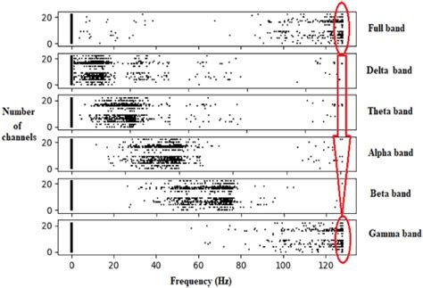 Figure 4 From An Iot Based Novel Hybrid Seizure Detection Approach For Epileptic Monitoring