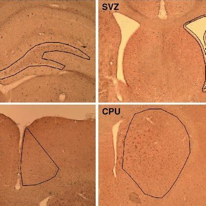 A Volumes Of The Areas Of Interest Anterior Cingulate Cortex ACC Download Scientific Diagram