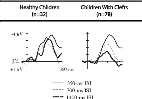 Figure 6 From The Mismatch Negativity Mmn A Unique Window To