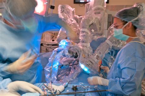 Robotic Heller Myotomy For Achalasia Laparoscopicmd