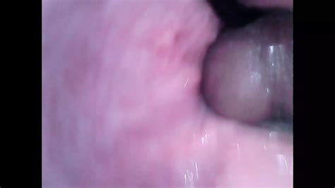 Endoscope Camera Inside My Ass Anal Anal Porn XHamster