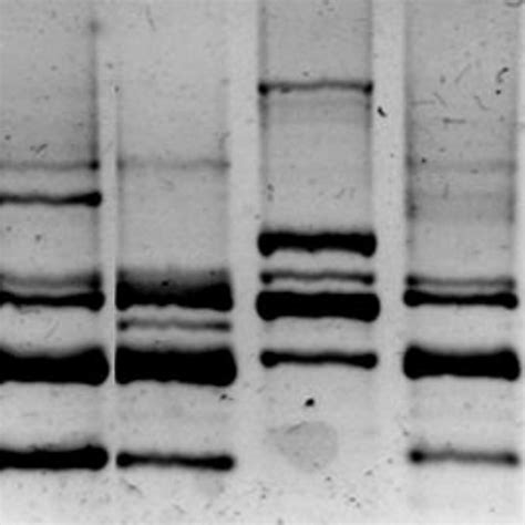 Pdf Identification Of Three Related Genera Salmonella Citrobacter And Proteus Using Api 20e