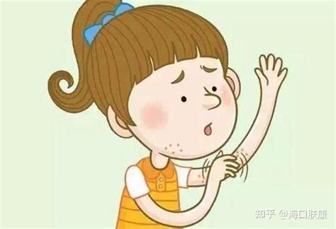 天气降温皮肤起疙瘩怎么办 知乎
