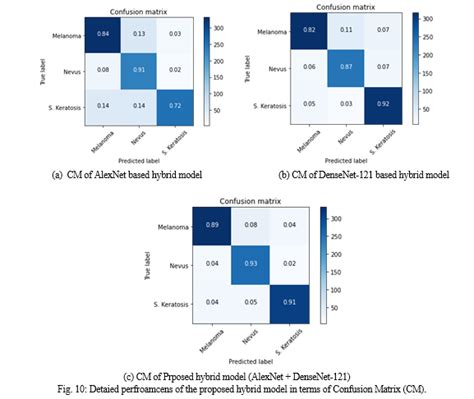 Alexnet And Densenet 121 Based Hybrid Cnn Architecture For Skin Cancer Prediction