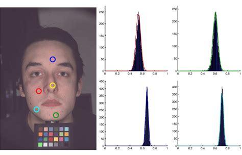 Example Hemoglobin Distributions And Their Gaussian Approximation For Download Scientific