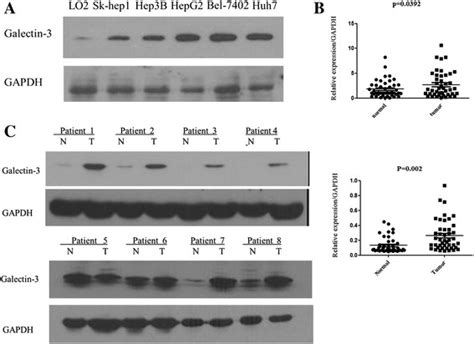 Expression Of Galectin 3 Mrna And Protein In Human Primary Hcc Cell