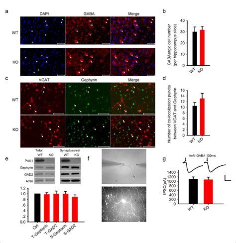 Normal Gabaergic Neurons Synapses Gaba Receptor Function And