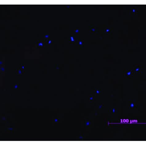 Patient Sample With Cell Nucleus Staining Hoesch And Download