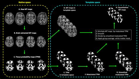 Preprocessing Pipeline Download Scientific Diagram