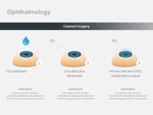 Ophthalmology Cataract PowerPoint Template SlideUpLift