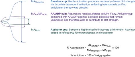 Point Of Care Viscoelastic Testing Bja Education