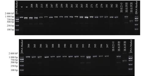 耐碳青霉烯类肺炎克雷伯菌及大肠埃希菌临床分离株耐药性及耐药基因分析