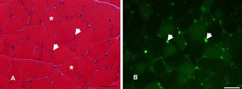 Fig S3 A Hande Stained Cross Sectional Micrographs Of Edl Showing