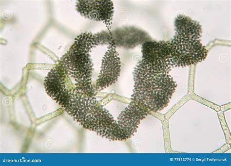 Freshwater Algae Identification
