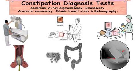 Diagnosis Of Constipation Physical Examination And Diagnosis Test For Constipation