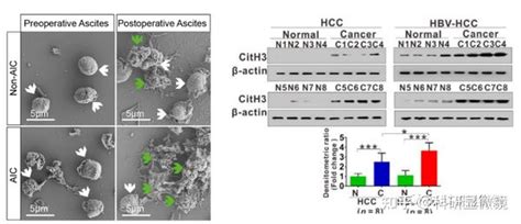 通过多篇10高分文献结果揭示国自然热点中性粒细胞胞外诱捕网（nets）相关实验 知乎